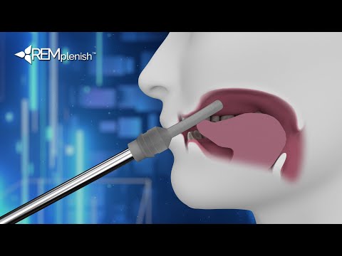 REMplenish Myo-Nozzle & Straw Kit – Empower Sleep